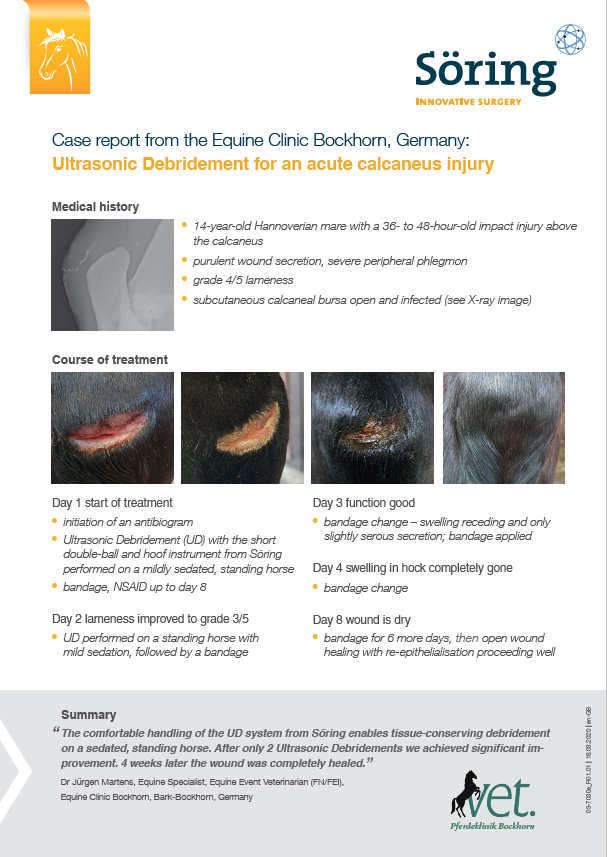 Söring Wound Debridement (UAW)