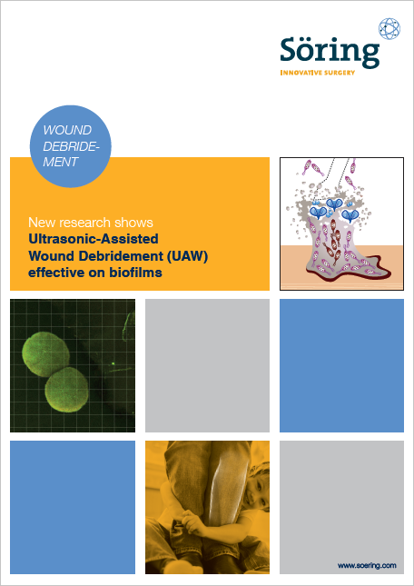 Söring Wound Debridement (UAW)